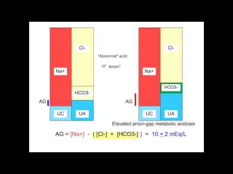 Metabolic Acidosis - Anion Gap -- M Lam