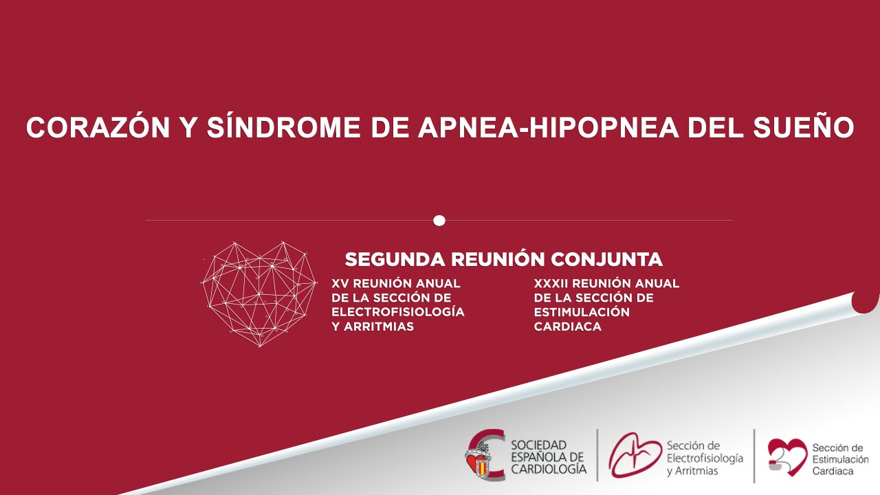 Corazón y síndrome de apnea-hipopnea del sueño - YouTube