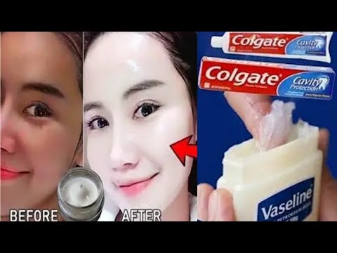 TOOTHPASTE and face mask with VASELINE! Glowing skin without wrinkles ...