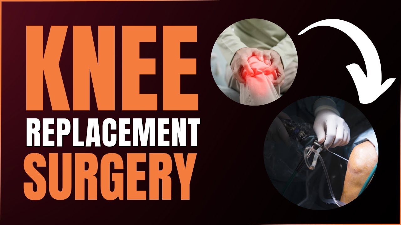 Ultimate Guide to Knee Replacement Surgery: Procedure, Recovery, and ...