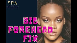 Broad Forehead