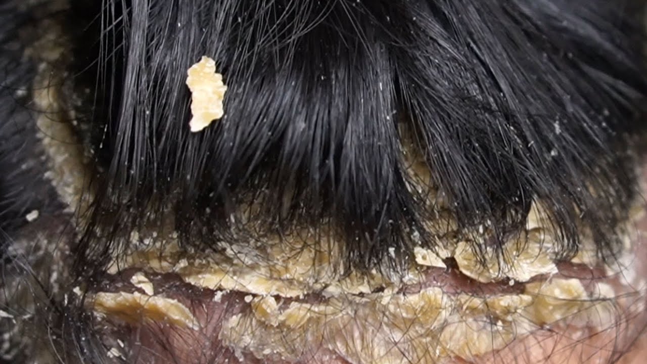 𝙍𝙚𝙡𝙖𝙭𝙞𝙣𝙜 𝘾𝙡𝙚𝙖𝙣𝙨𝙞𝙣𝙜 𝙛𝙤𝙧 𝙖 𝙋𝙚𝙖𝙘𝙚𝙛𝙪𝙡 𝙈𝙞𝙣𝙙 with Comb #189 - YouTube