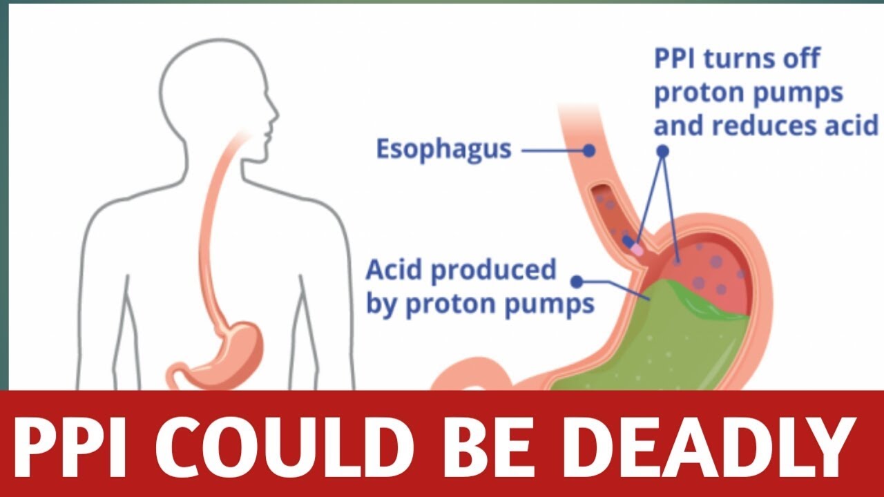 Proton pump inhibitors (PPIs) : 3 dangerous side effects - YouTube