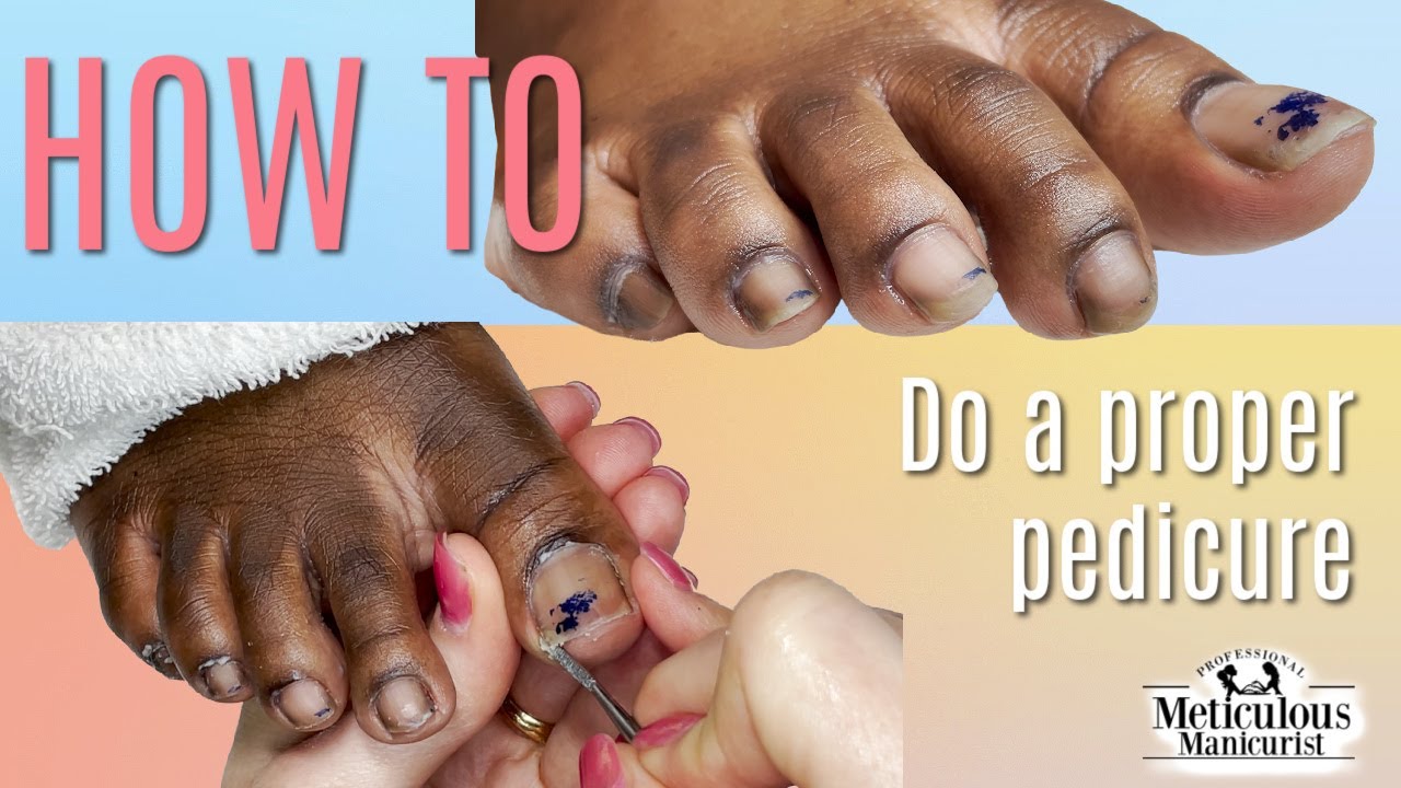 Toenail Pressure Relieved with Proper Pedicure Cleaning - YouTube