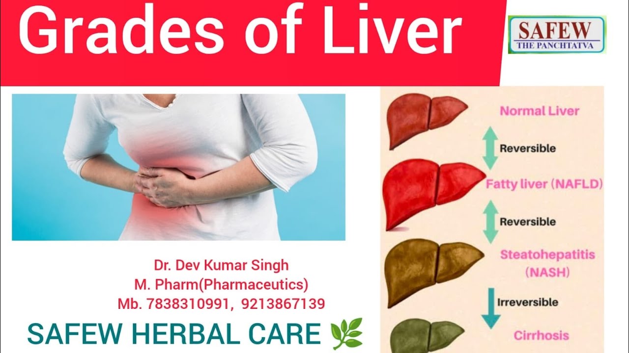 Grades of Liver | Dr. Dev Kumar Singh | Safew herbal care 🌿 - YouTube