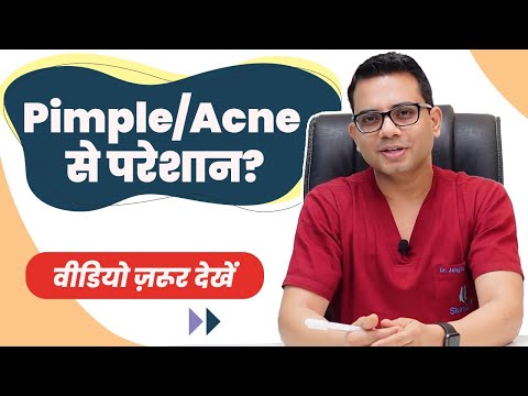 Are you suffering from Pimple/Acne? Watch this video | Dr. Jangid | SkinQure Delhi