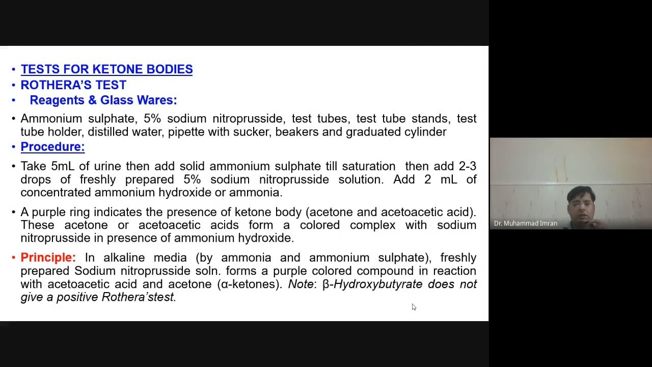 Rothera's Test for Ketone bodies - YouTube