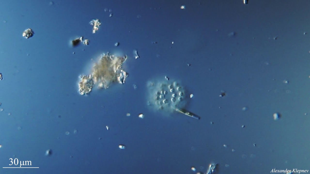 Algae under microscope - YouTube