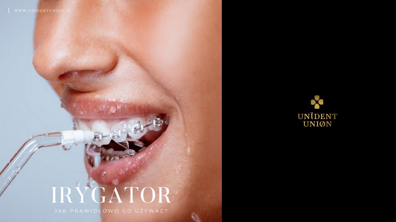 UNIDENT UNION IRYGATOR - YouTube