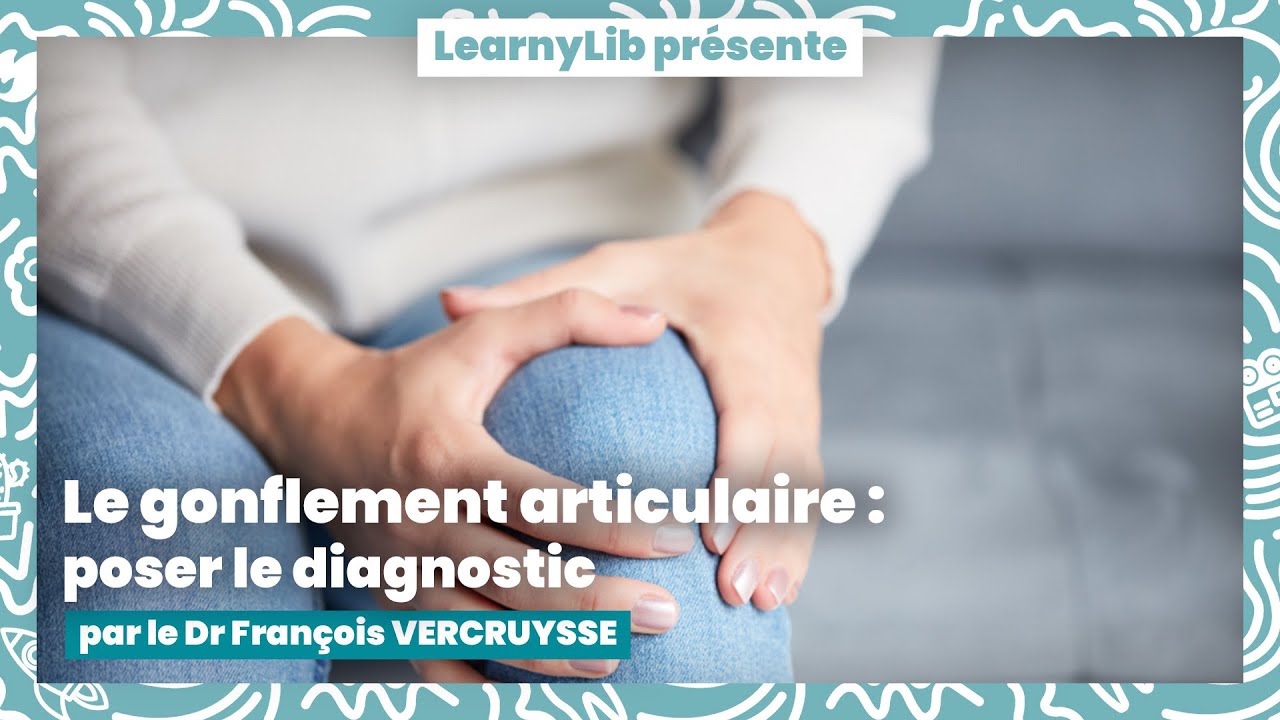 🩺 Gonflement articulaire : poser le diagnostic avec le Dr François ...