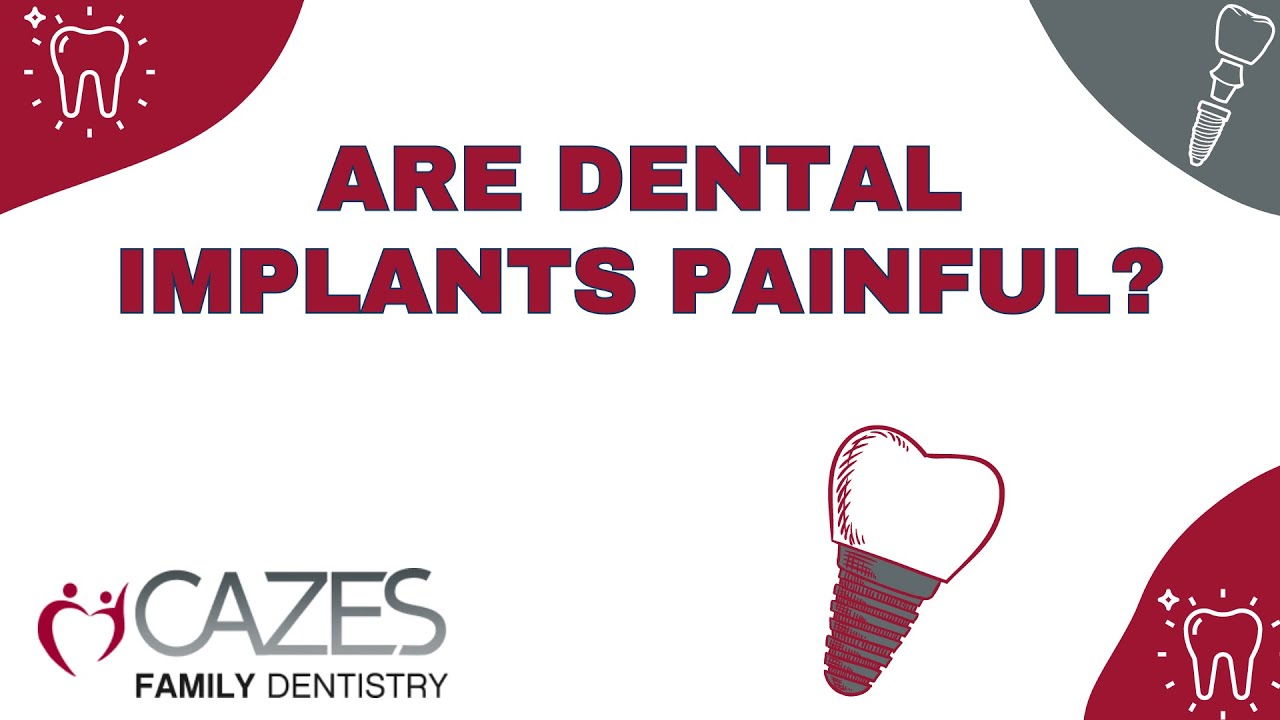 Cazes Family Dentistry - Are Dental Implants Painful? - YouTube