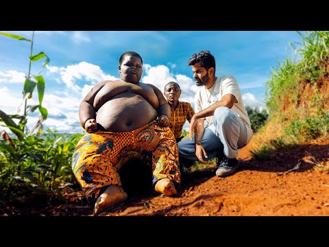 Conocí a un niño gigante-el pesa 100 kilos y tiene 5 años