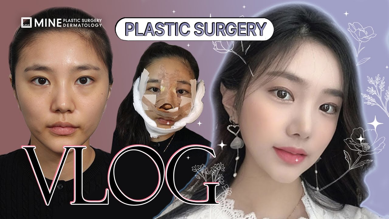 VLOG Plastic Surgery || Facial Contouring, Rhinoplasty - YouTube