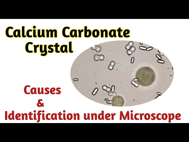 Calcium Carbonate Crystals