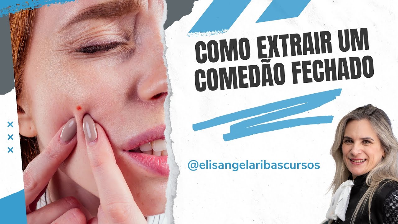 COMO EXTRAIR UM COMEDÃO FECHADO - YouTube