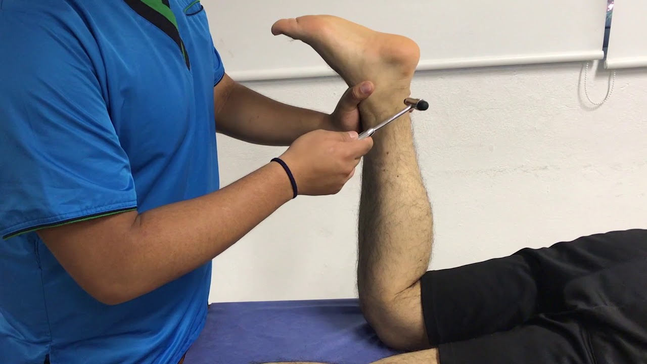 Signo de Tinel tobillo - YouTube