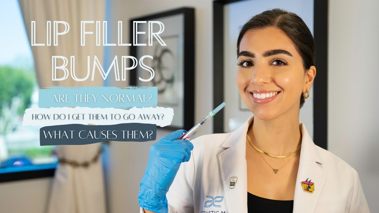 Lip Filler Bumps! Are they Normal? - YouTube