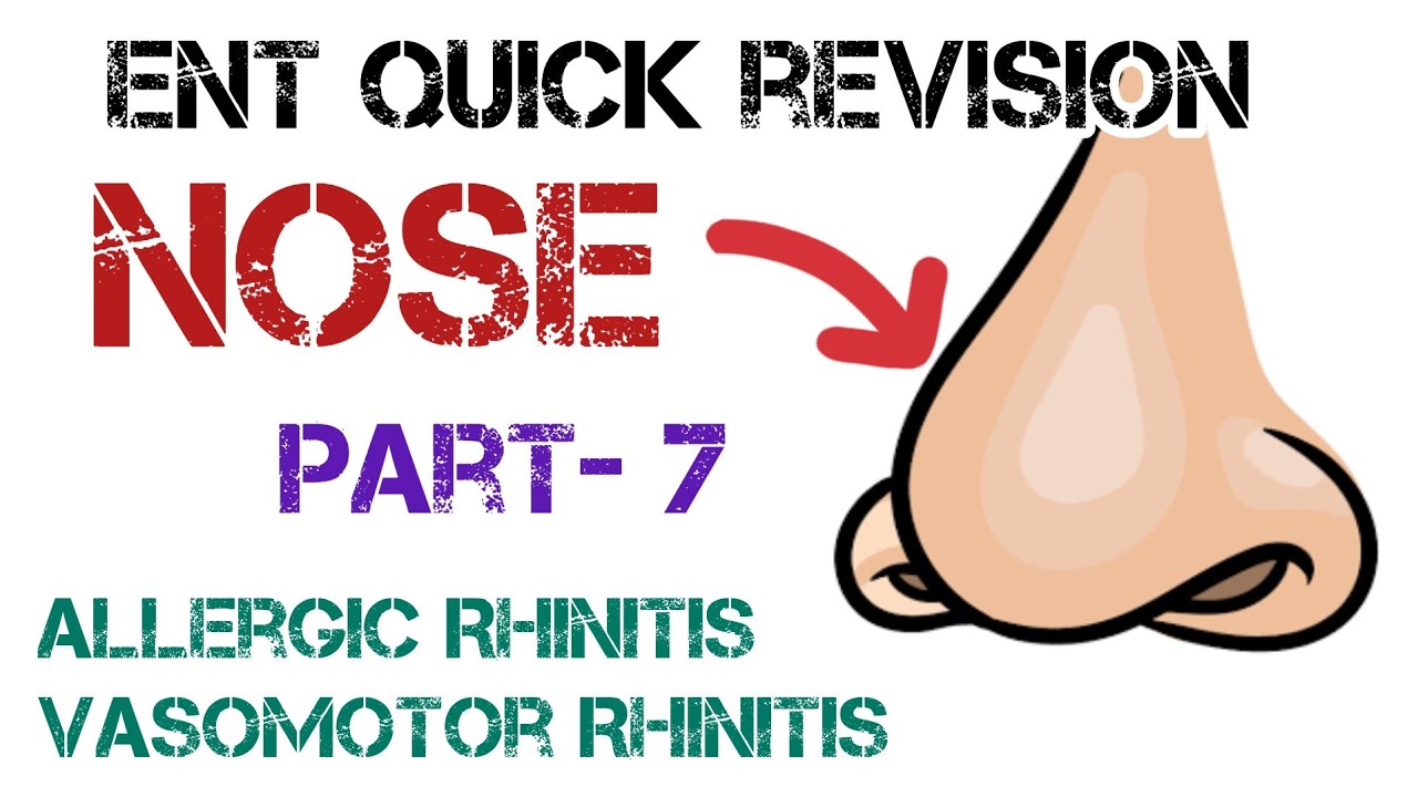 Allergic Rhinitis & Vasomotor Rhinitis. - YouTube
