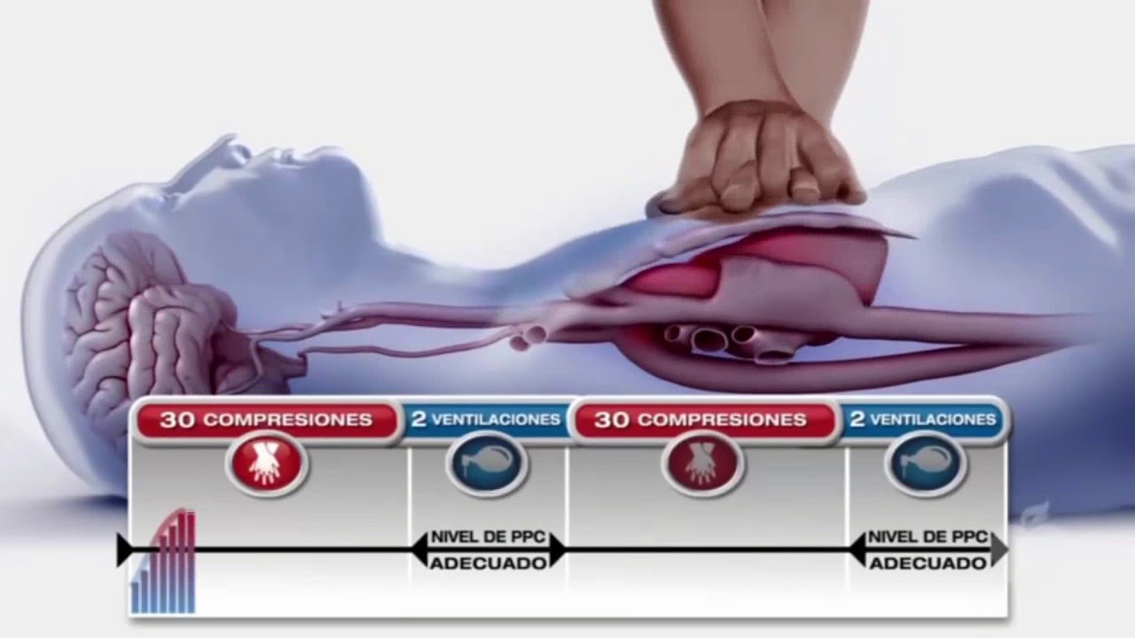 RELACIÓN ENTRE LAS COMPRESIONES CARDÍACAS Y LA PRESIÓN DE PERFUSIÓN ...