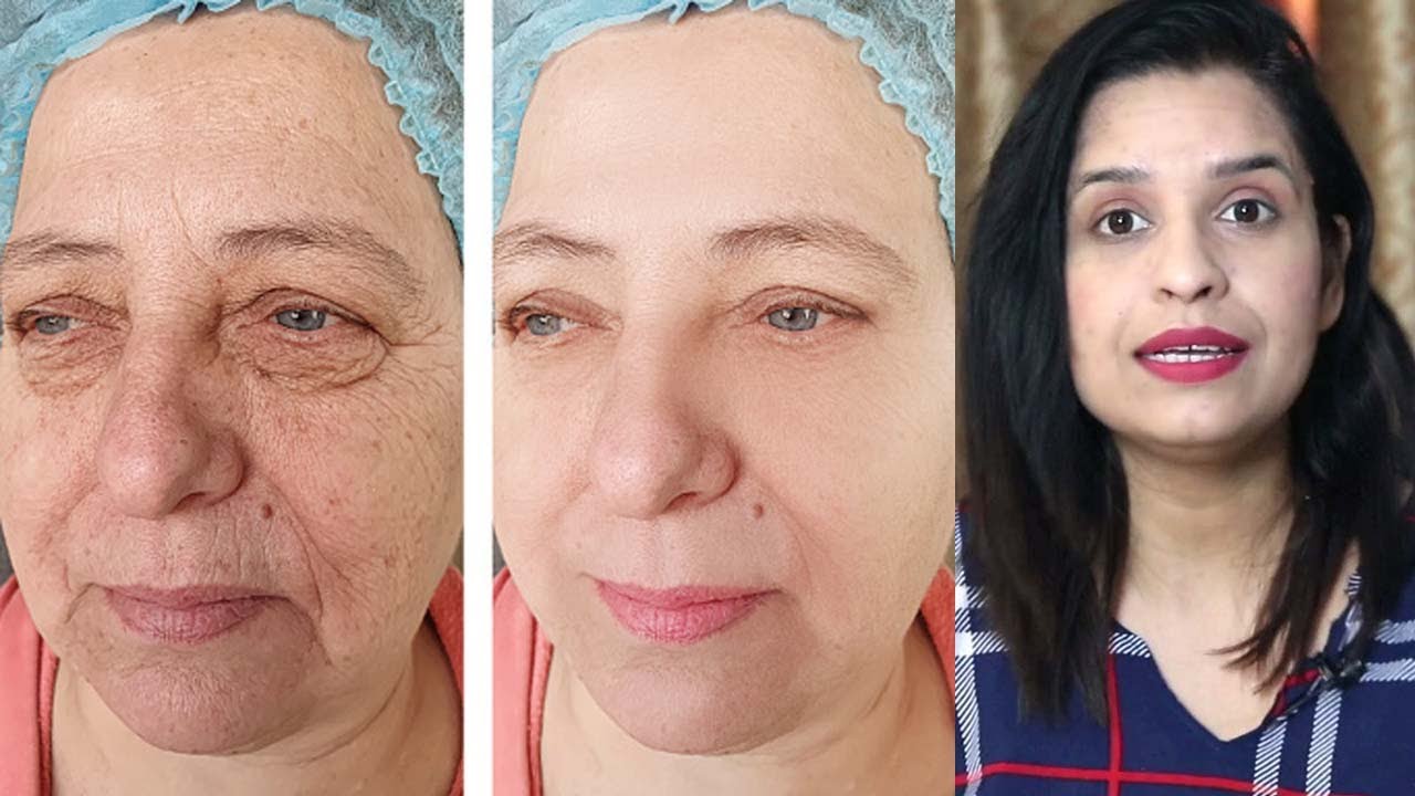 Anti Ageing Challenge Remove Wrinkles Fine Lines Open Pores And Get