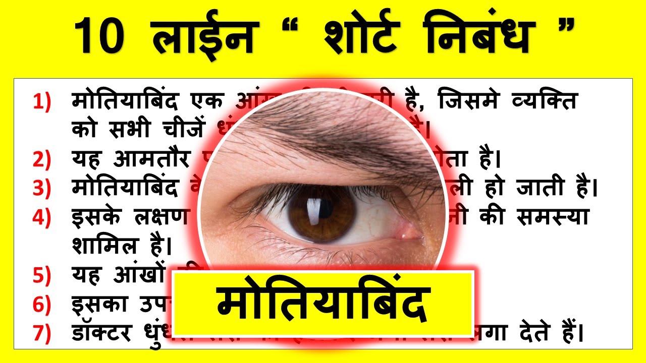 10 Lines on Cataracts in Hindi | 10 Lines on Motiyabind in Hindi ...