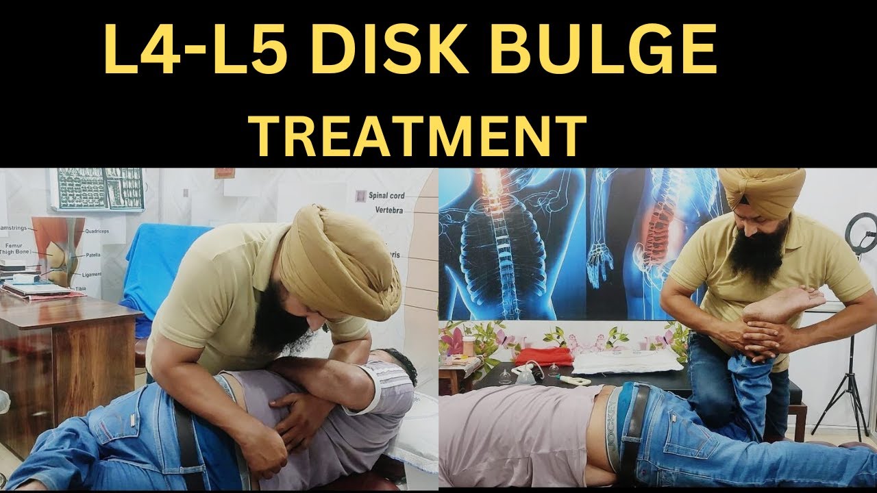 L4-L5 DISK BULGE TREATMENT - YouTube