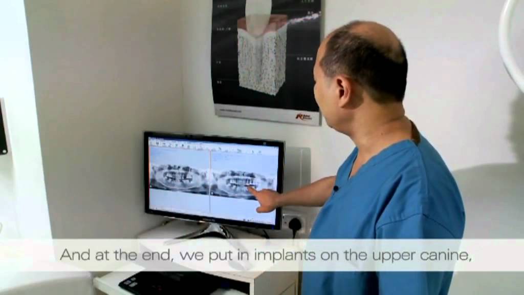 Mr. Wan - Nobel Biocare Patient Testimonials - YouTube