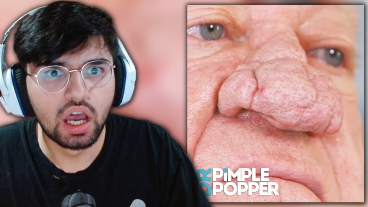 This Man Has a Nose the Size of a Plum! REACTION - YouTube