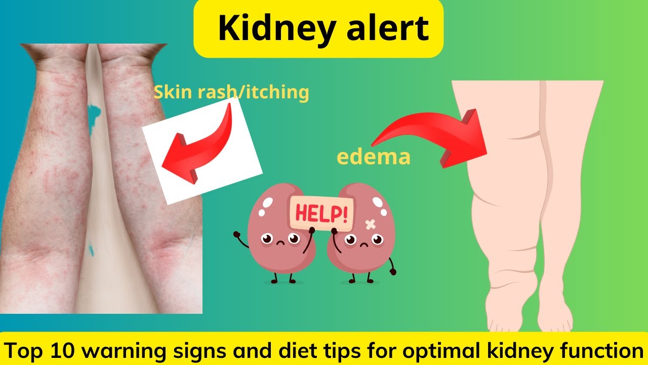 Kidney alert: Top 10 warning signs and diet tips for optimal kidney ...