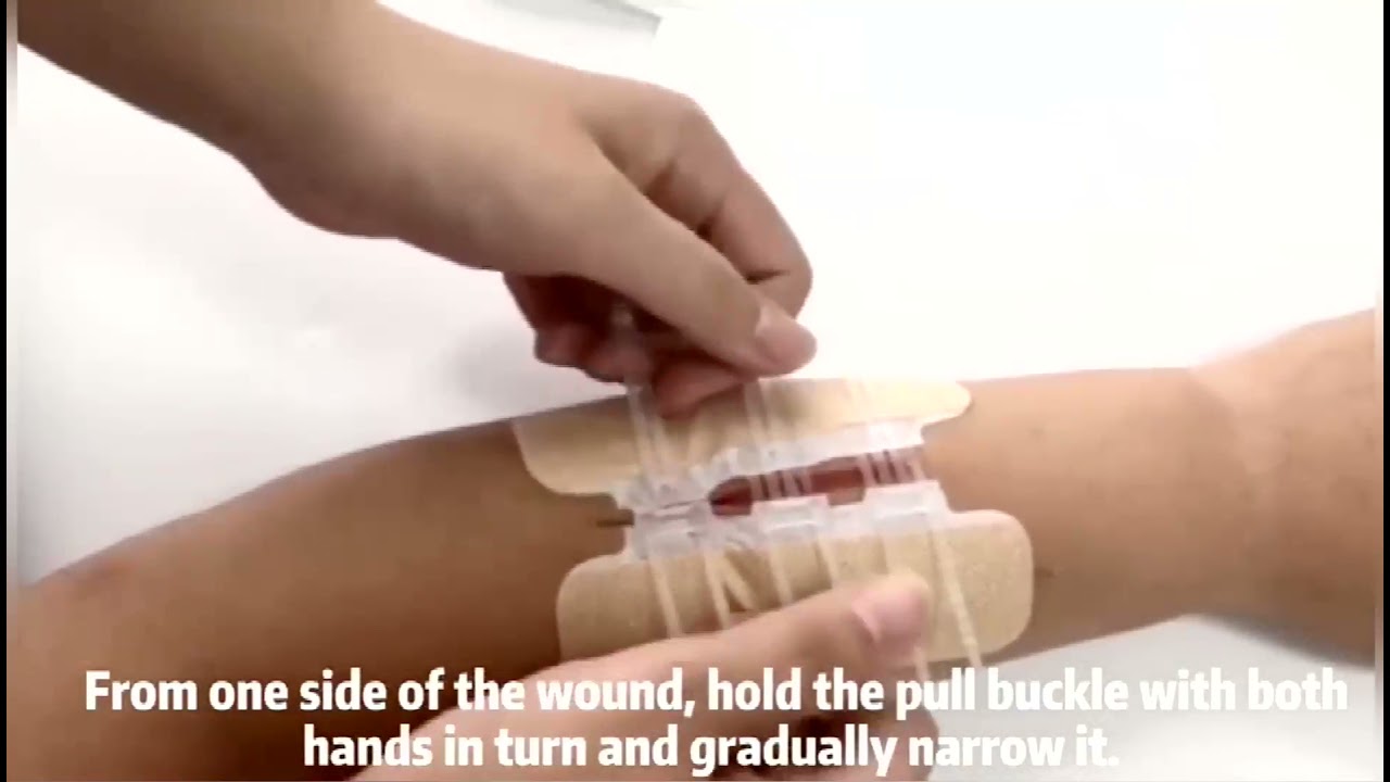 How to Use Disposable Medical Zip Wound Closure Device Without Stitches ...