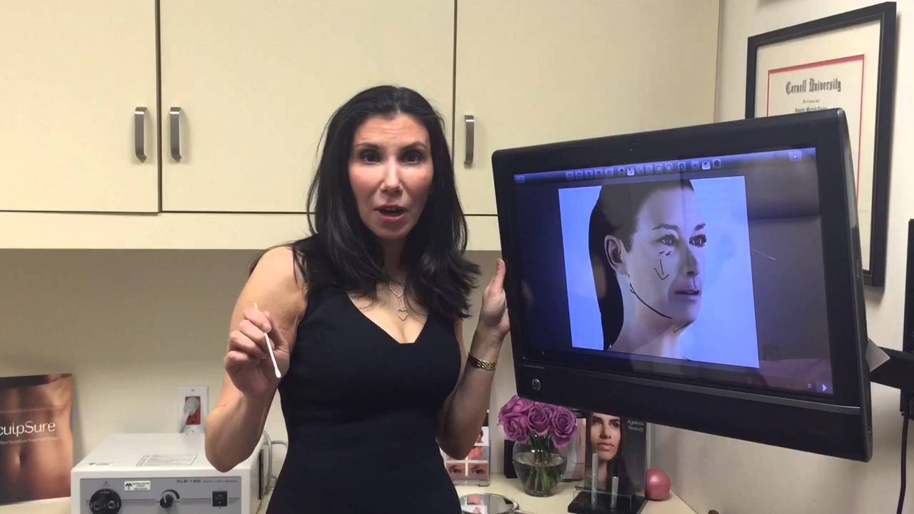 Facelift NYC - NY Plastic Surgeon Jennifer Levine explains who is a ...