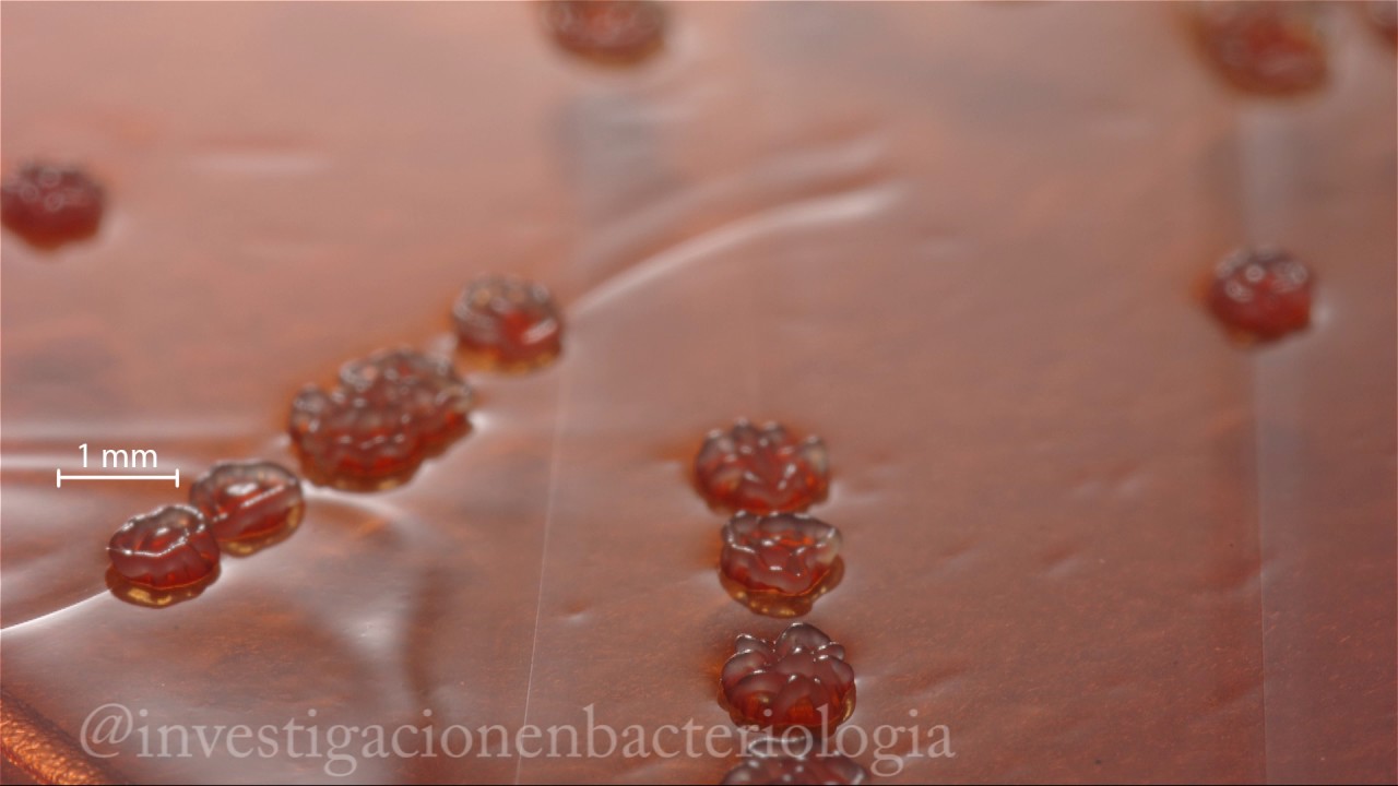 Pseudomonas stutzeri McConkey 60 horas - YouTube