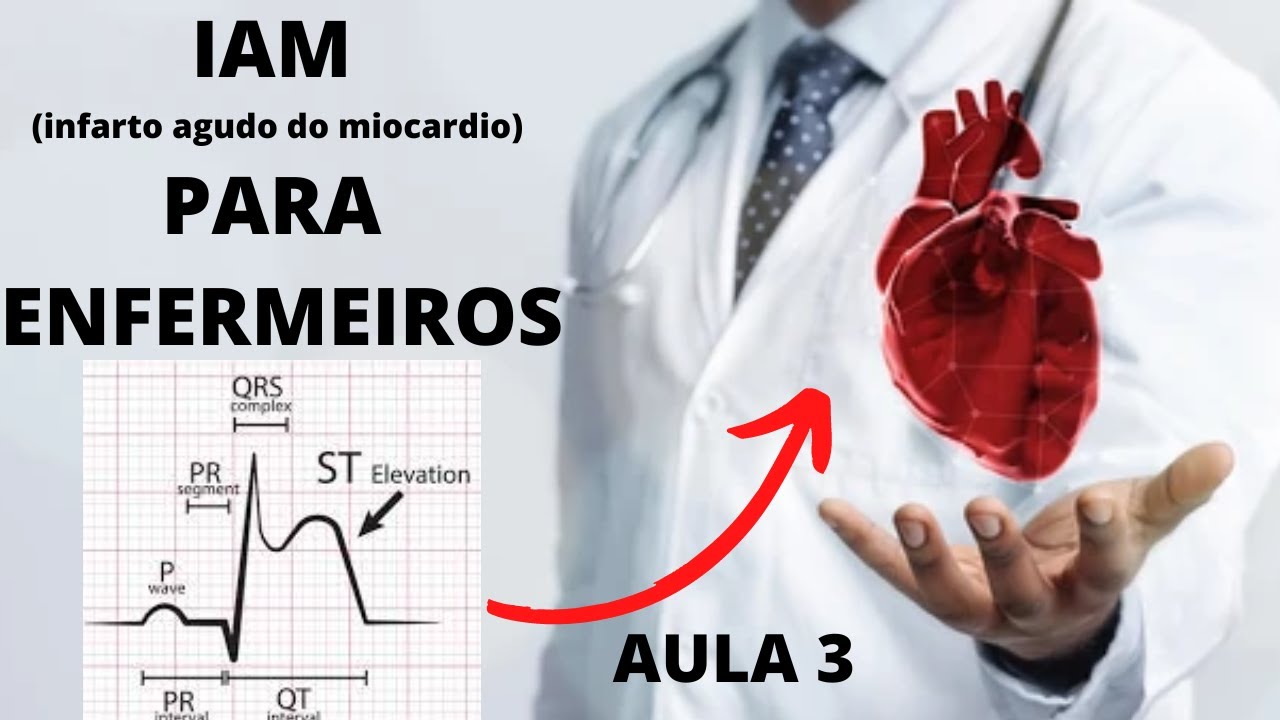 Aula 3 IAM com Supra ST - Principais medicações usadas no IAM com supra ...