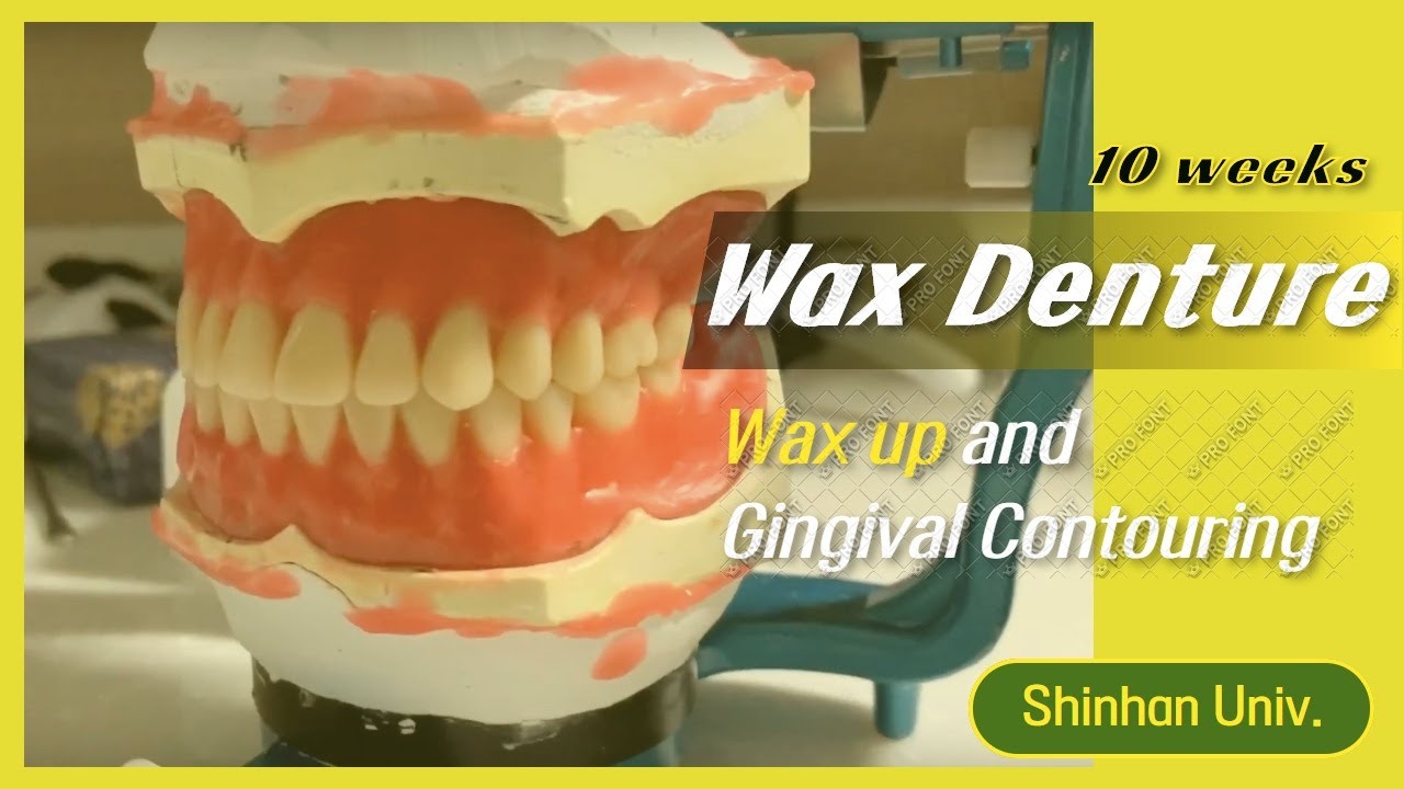 (10 weeks) Wax up and gingival contouring - YouTube
