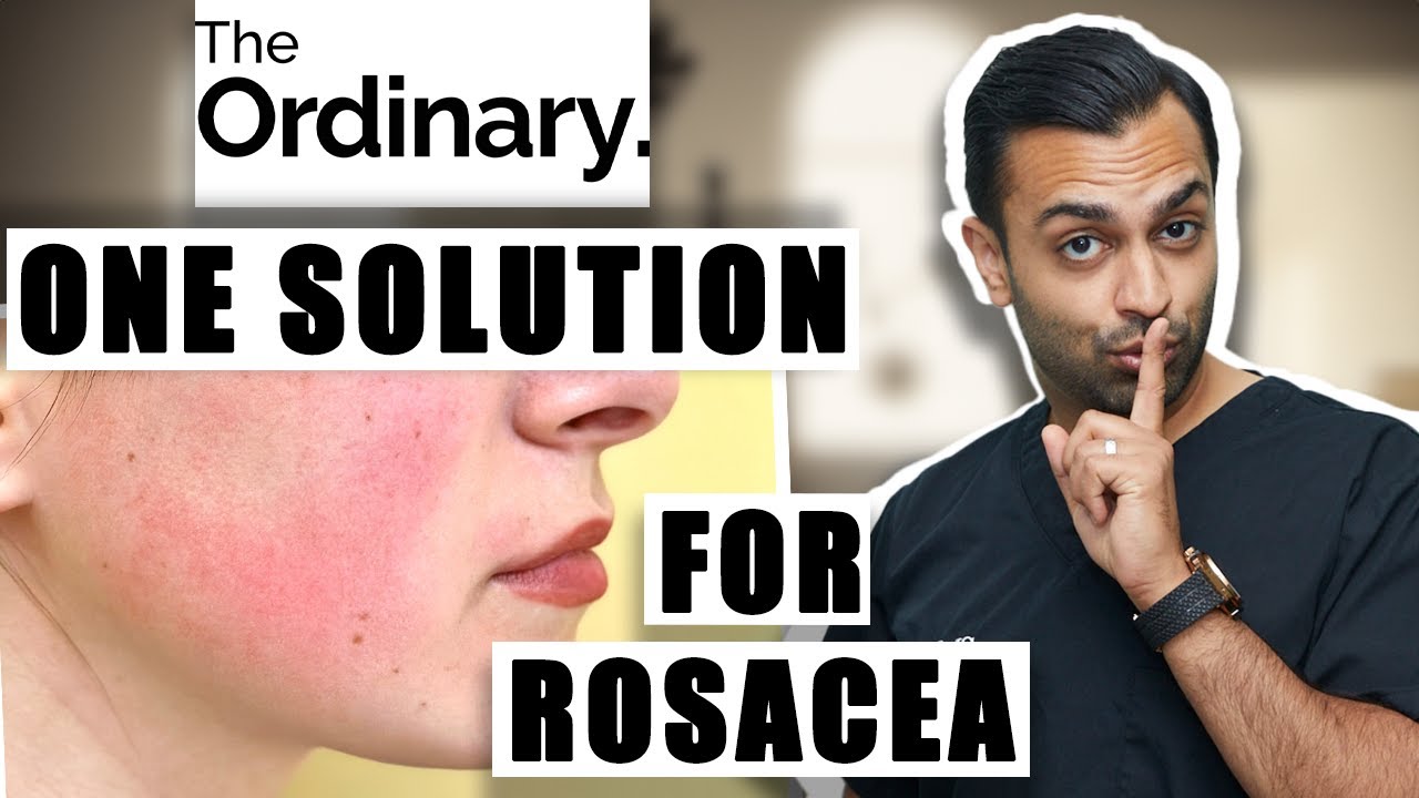 You Should Try These Products | Rosacea Relief - YouTube