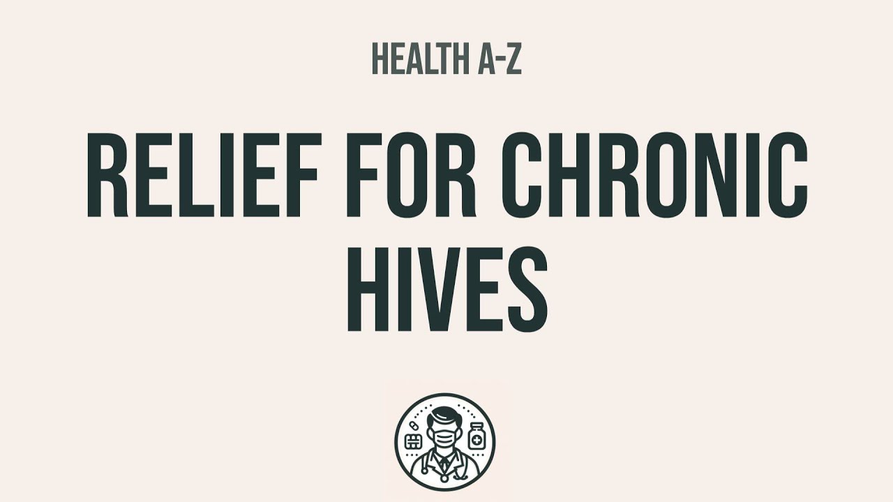 Managing Chronic Hives: Treatment Options - YouTube