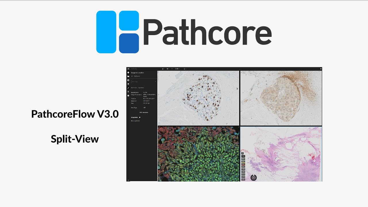 PathcoreFlow V3.0 - Split-View - YouTube