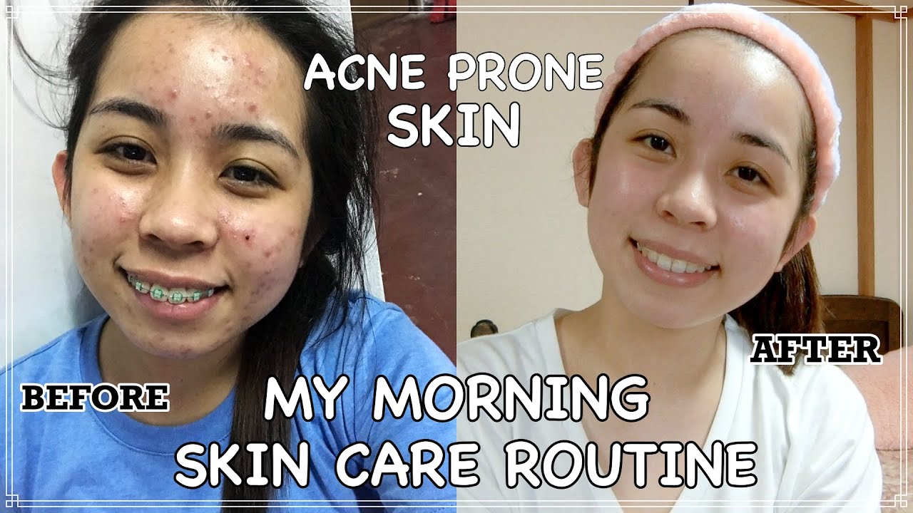 MY MORNING SKIN CARE ROUTINE (ACNE PRONE SKIN) - MoniqueTakeda 🌸 - YouTube