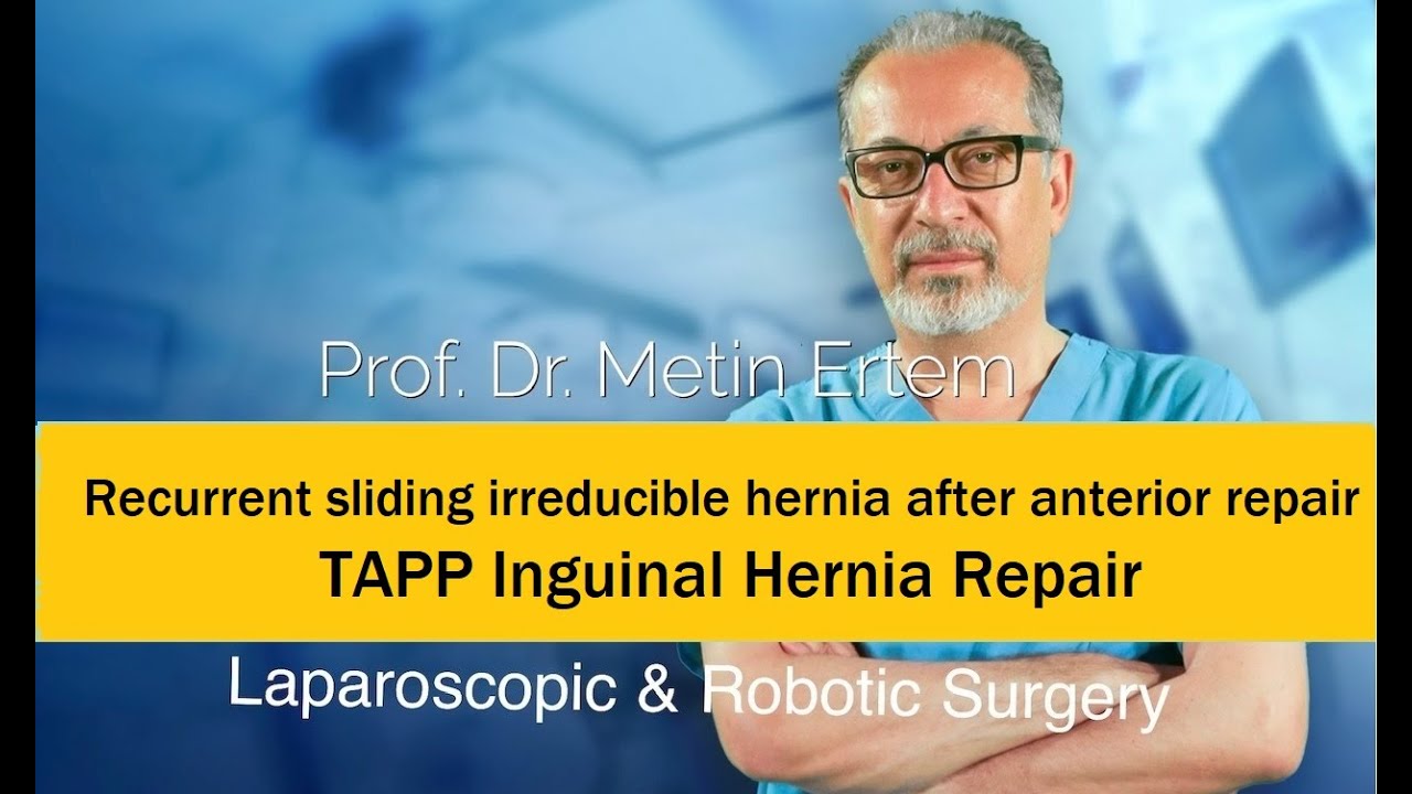 Irreducible sliding inguinal hernia . TAPP Repair. Metin Ertem MD.FACS ...