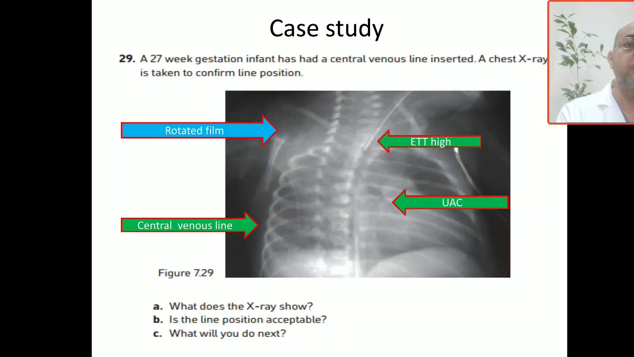 Case 109 central venous line malposition, interpretation, indications ...
