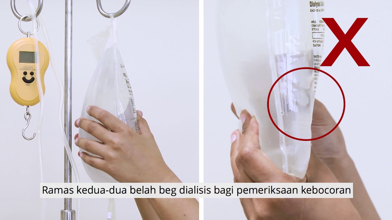 Ambulatory Peritoneal Dialysis (CAPD) Step-By-Step Guide - (Malay ...