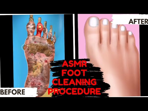 ASMR FOOT CLEANING PROCEDURE VIDEO - YouTube
