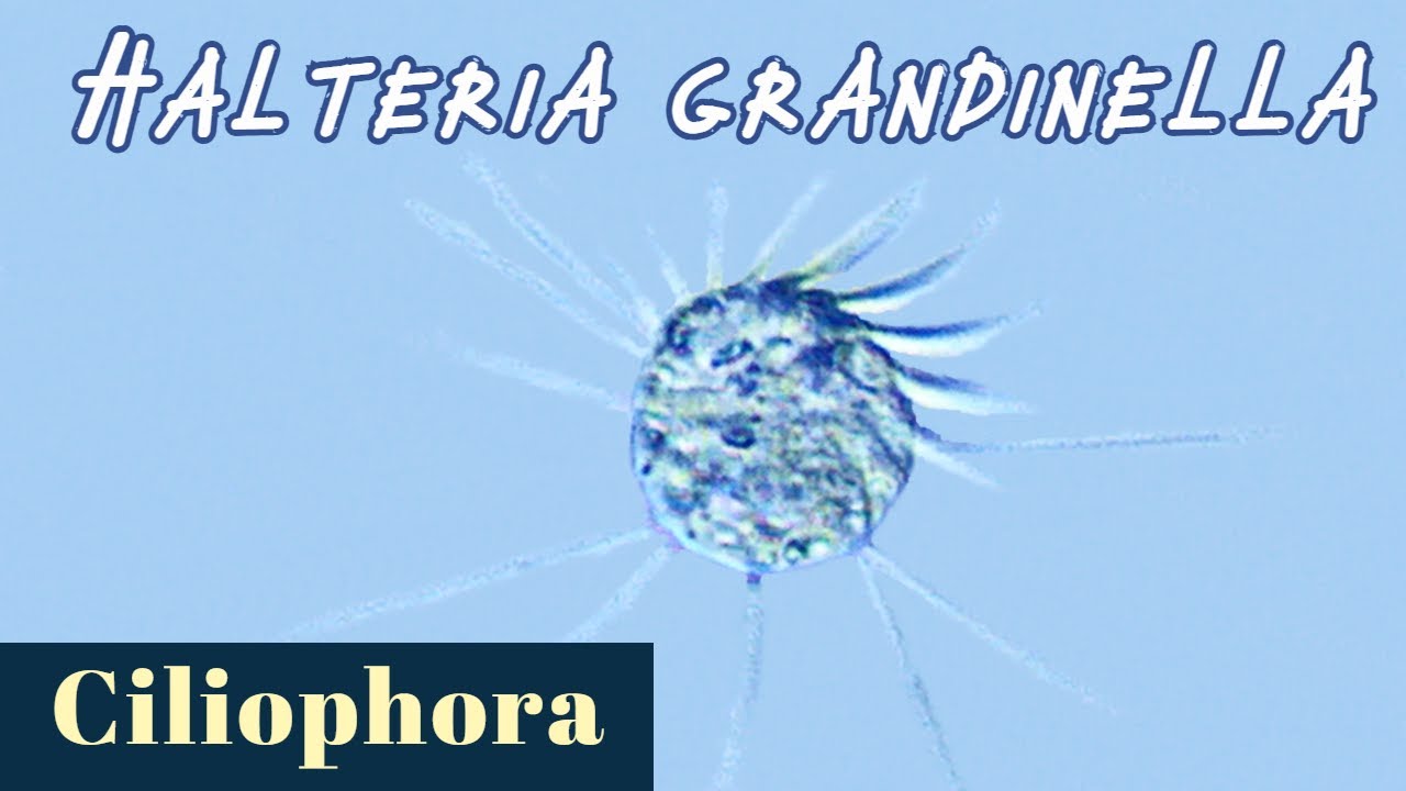 Halteria grandinella (Ciliophora or Ciliate) - YouTube