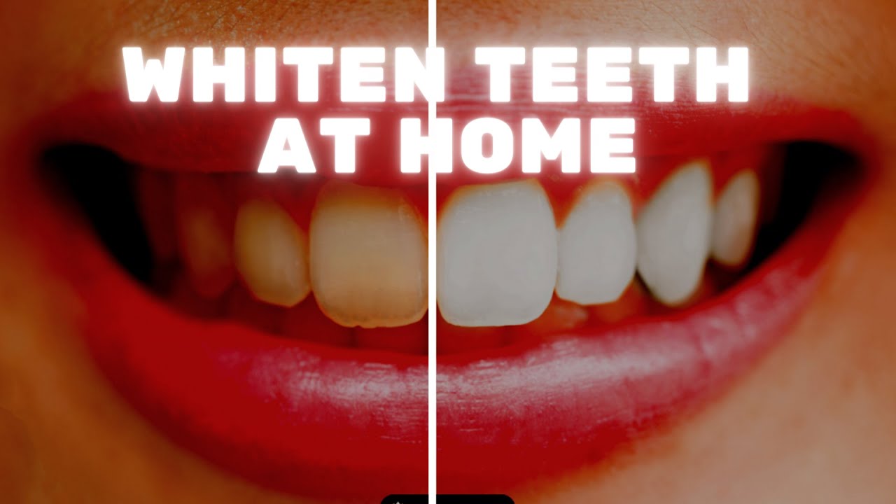 The Best Ways To Whiten Teeth Youtube