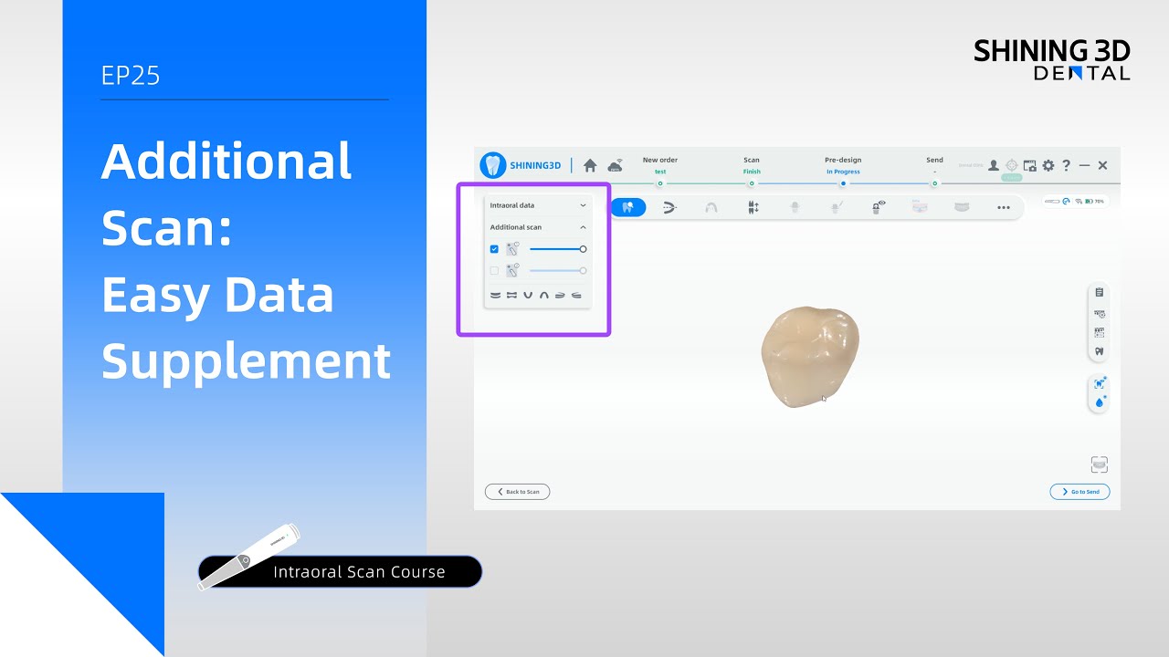 Intraoral Scan Course EP25｜Additional Scan: Easy Data Supplement - YouTube