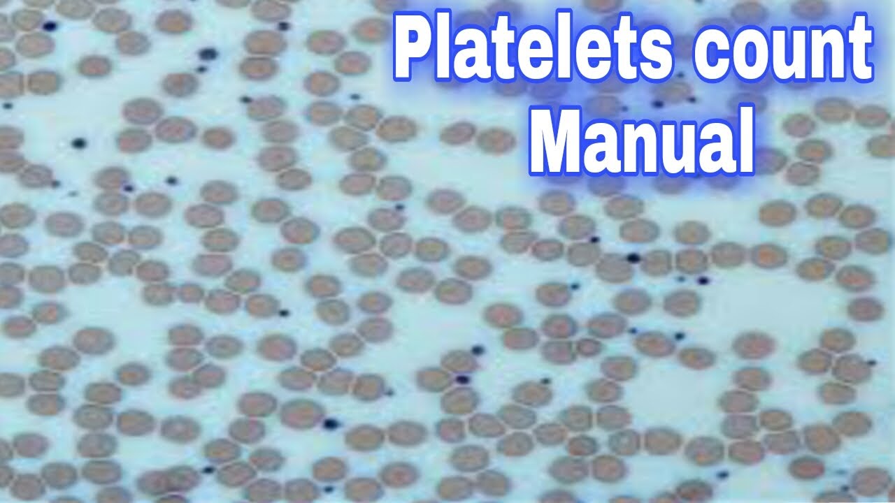 Platelets_Count_by_manual_by peripheral blood smear - YouTube