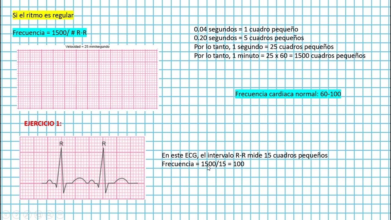 Como sacar la FRECUENCIA en el EKG (Clases EKG #8) - YouTube