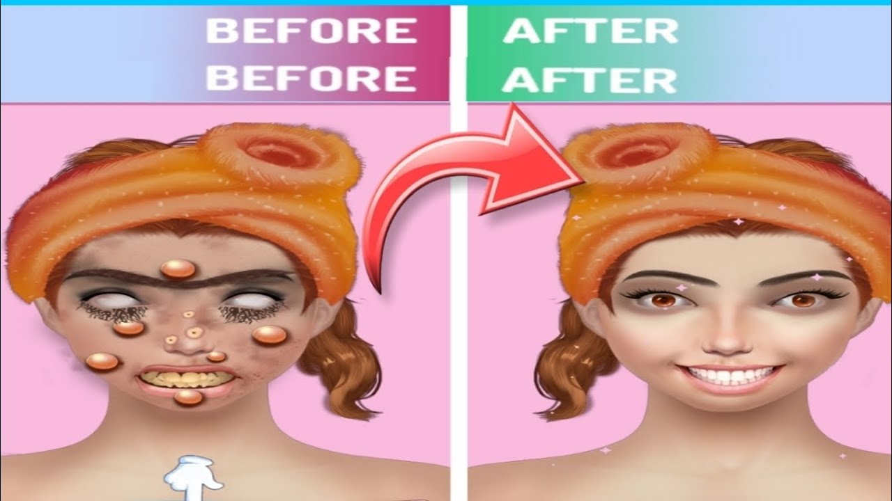 ASMR Blackhead removal collection and treatment to remove secretions ...