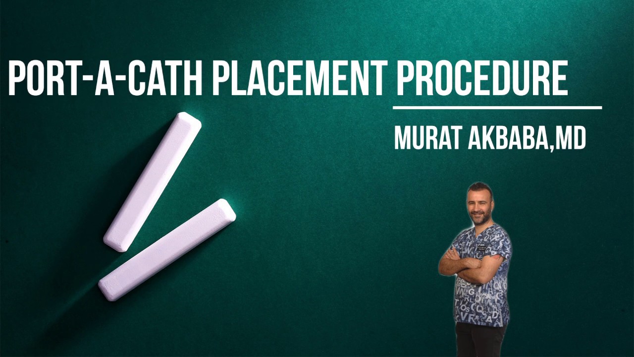 SUBCUTANEOUS CATHETER (Port Catheter) PLACEMENT By Murat AKBABA,MD( KT ...
