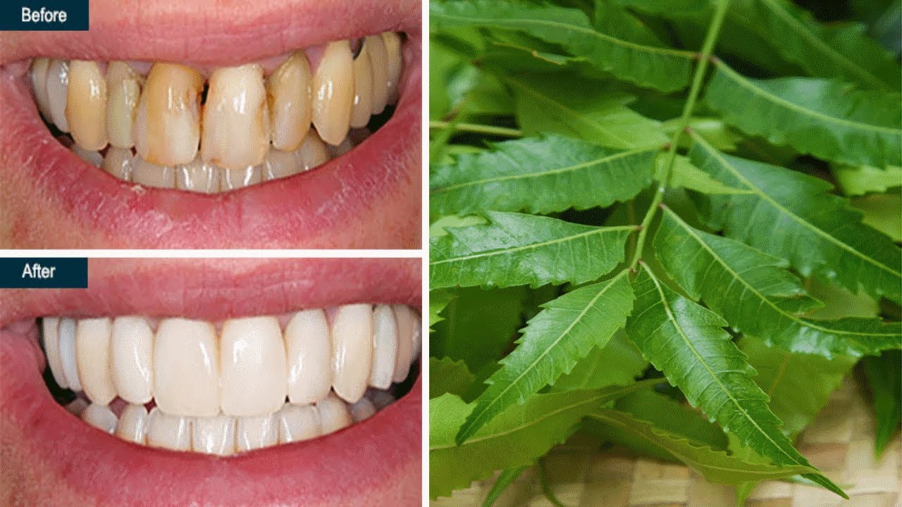 8 Natural Ways to Make Your Teeth Whiter at Home - YouTube